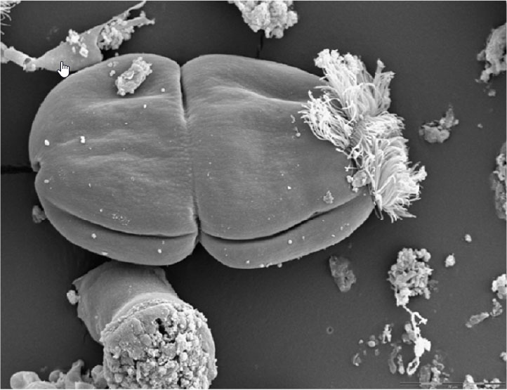 Infusorienübersicht