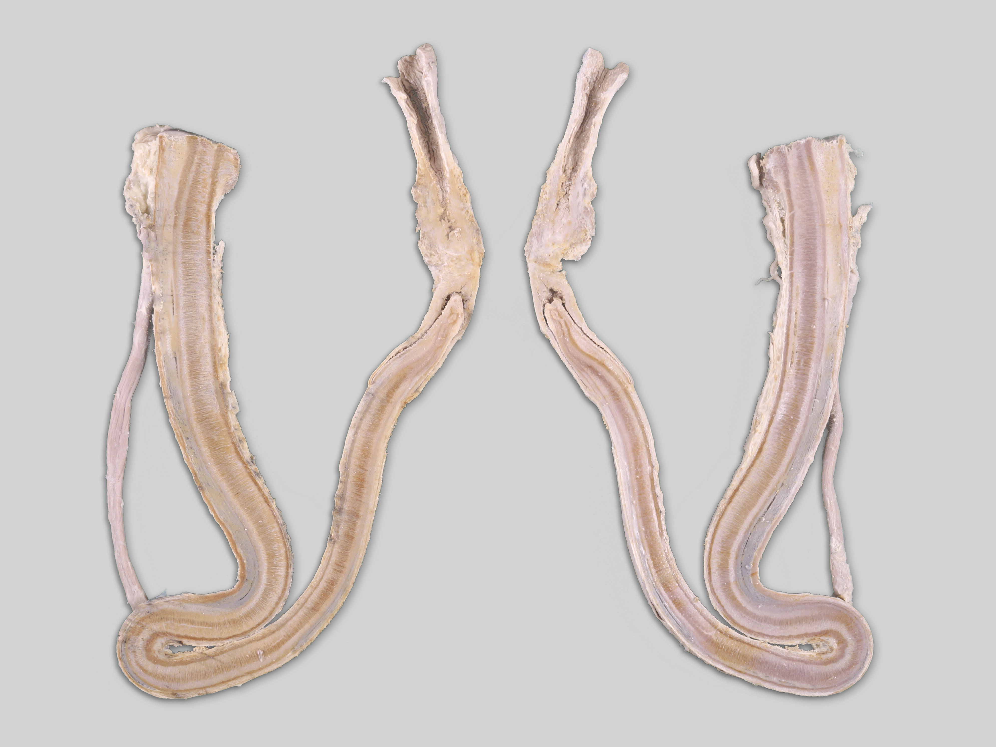 Glied, Penis, Phallus - Medianschnitt (Rind)