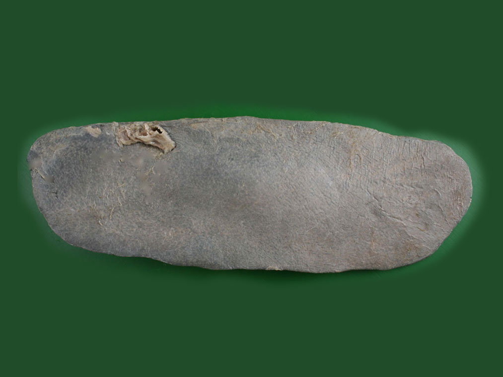 Milz, Lien, Splen - Facies visceralis (Rind)