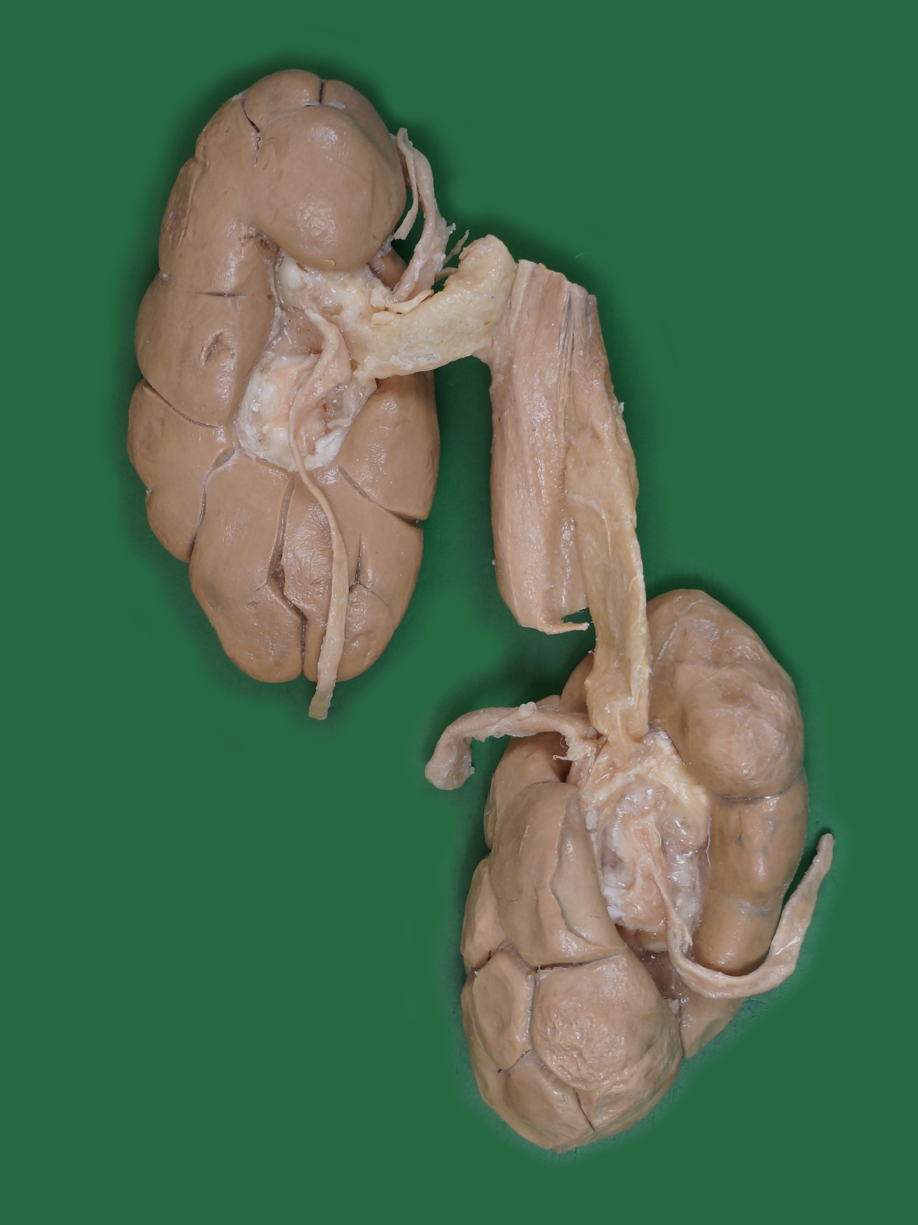 Niere, Ren, Nephros - Facies ventralis (Rind)