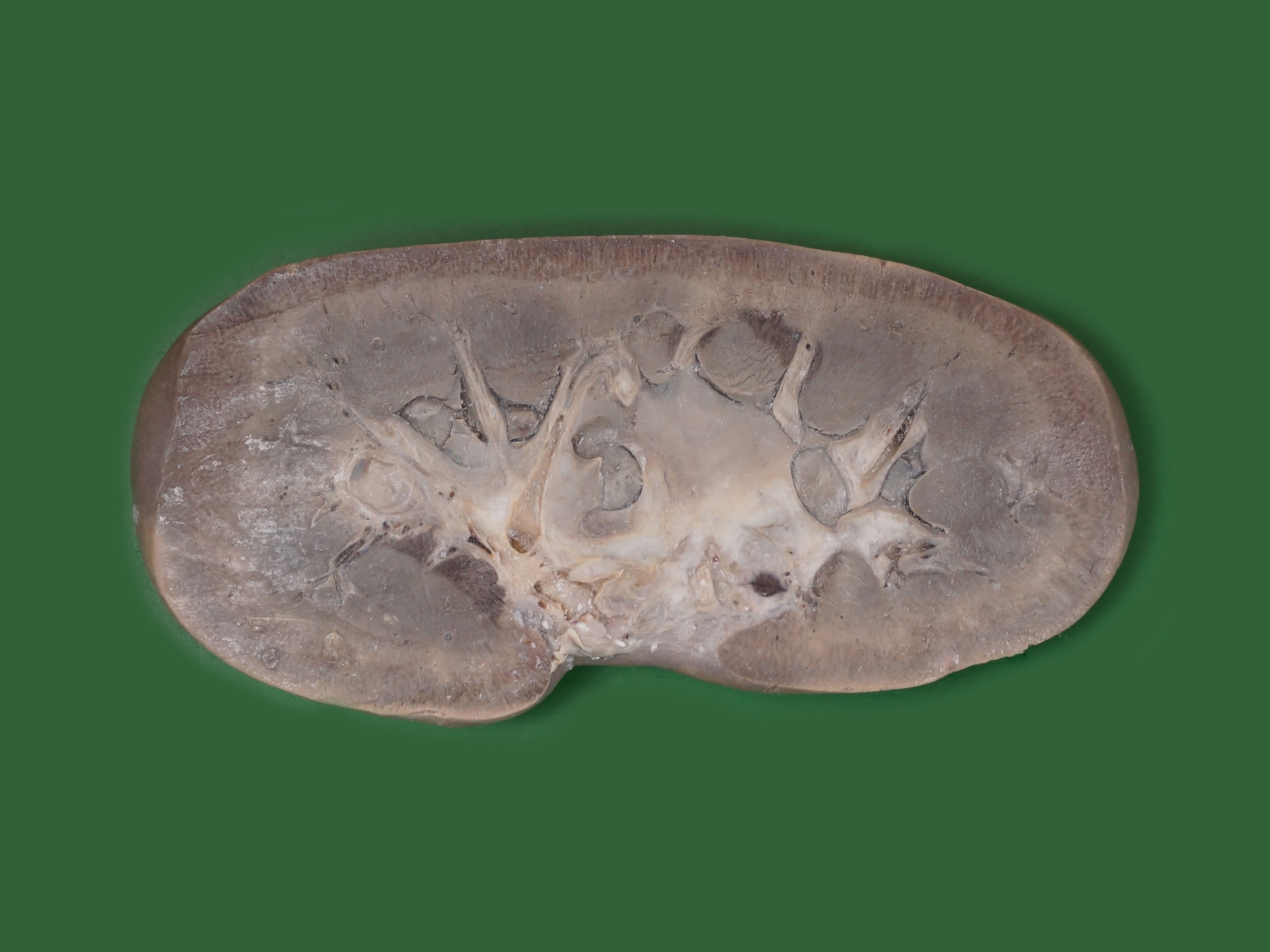 Niere, Ren, Nephros - Sectio sagittalis (Schwein)