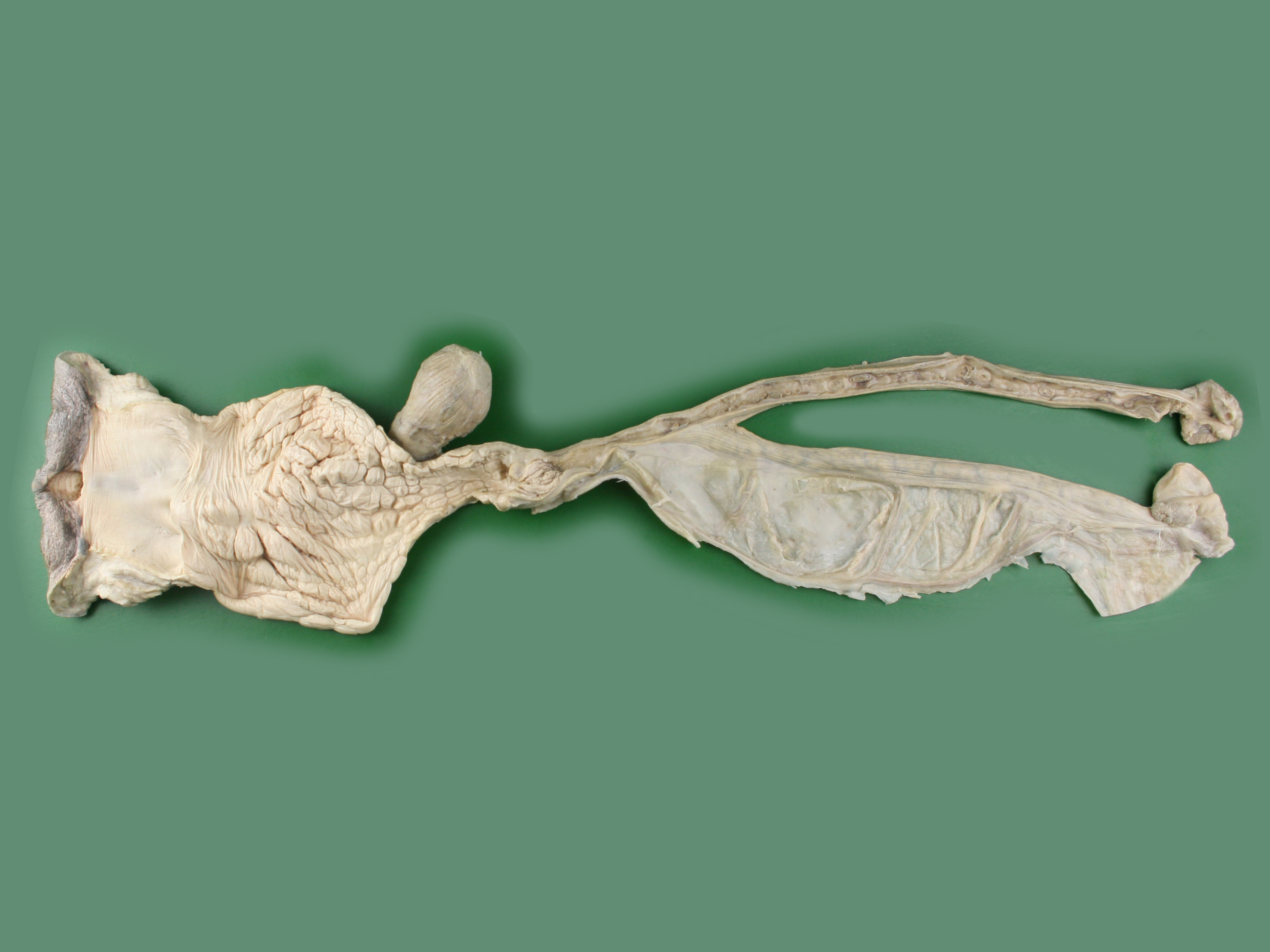 Weibliche Geschlechtsorgane, Organa genitalia feminina - teilweise ...