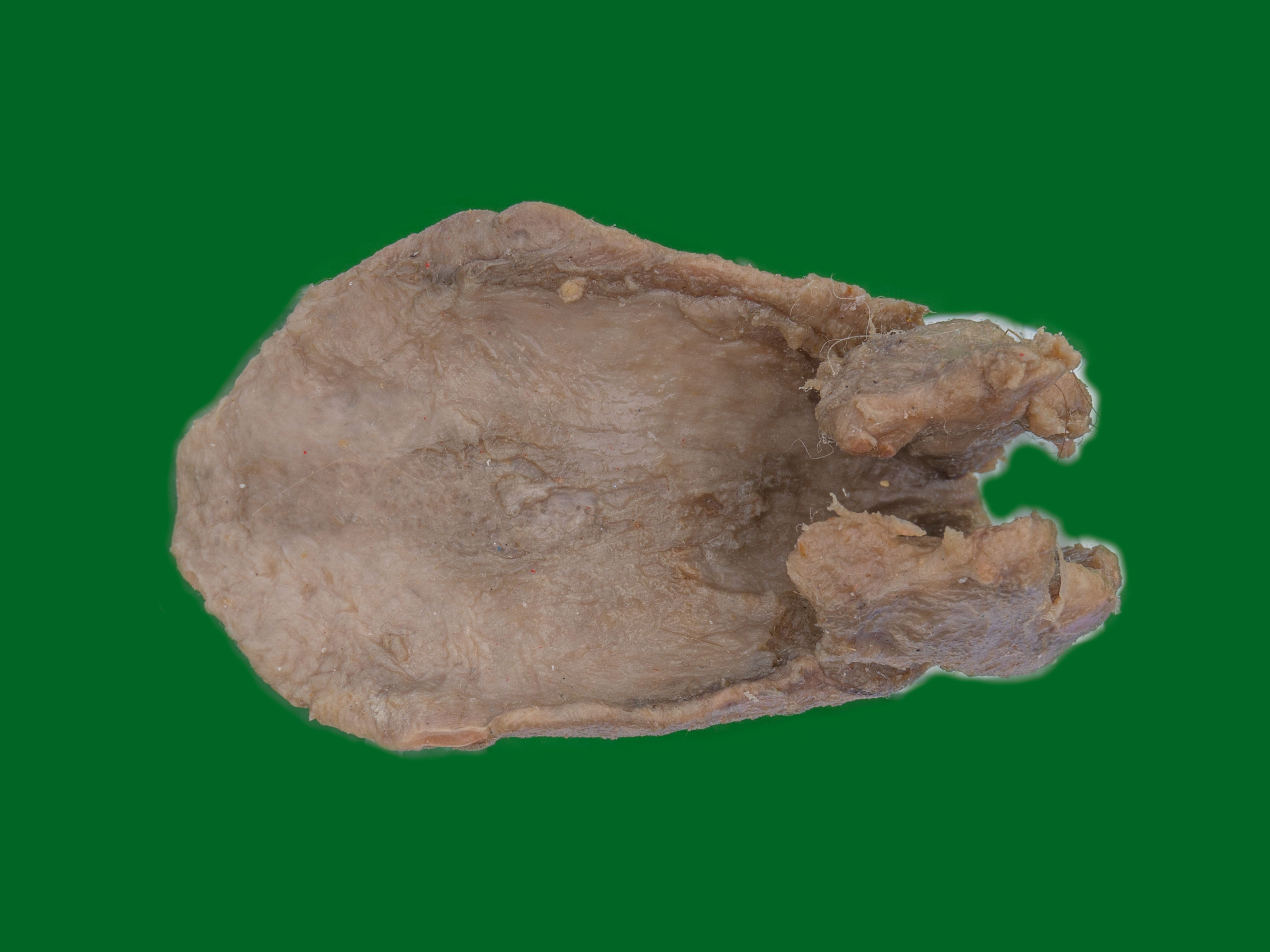 Kehldeckel und Kehlkopfvorhof, Epiglottis et Vestibulum laryngis ...