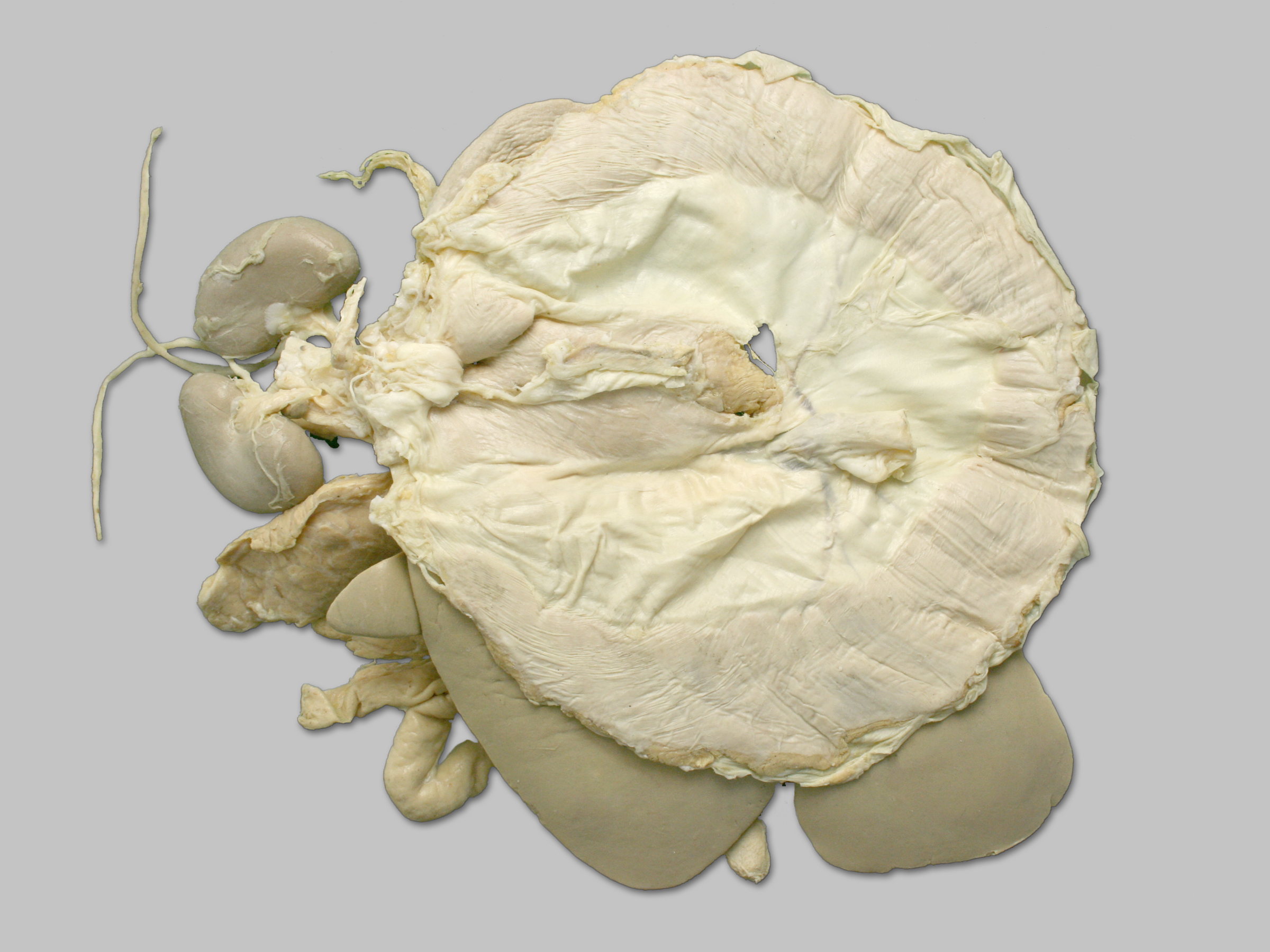 Zwerchfell, Diaphragma mit angrenzenden Organen - Facies thoracica (kl ...